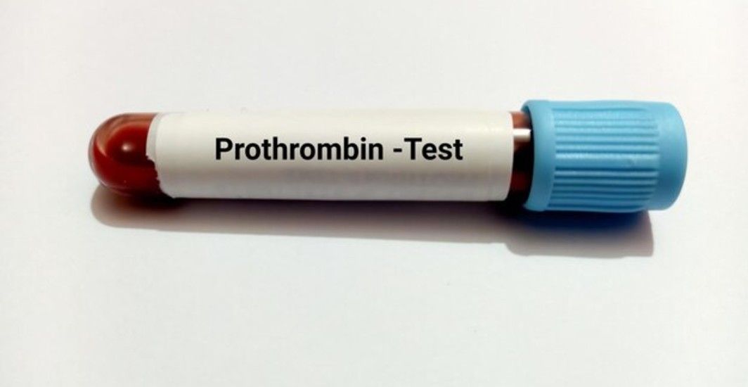 PT INR Normal Range: Prothrombin Time Levels Guide
